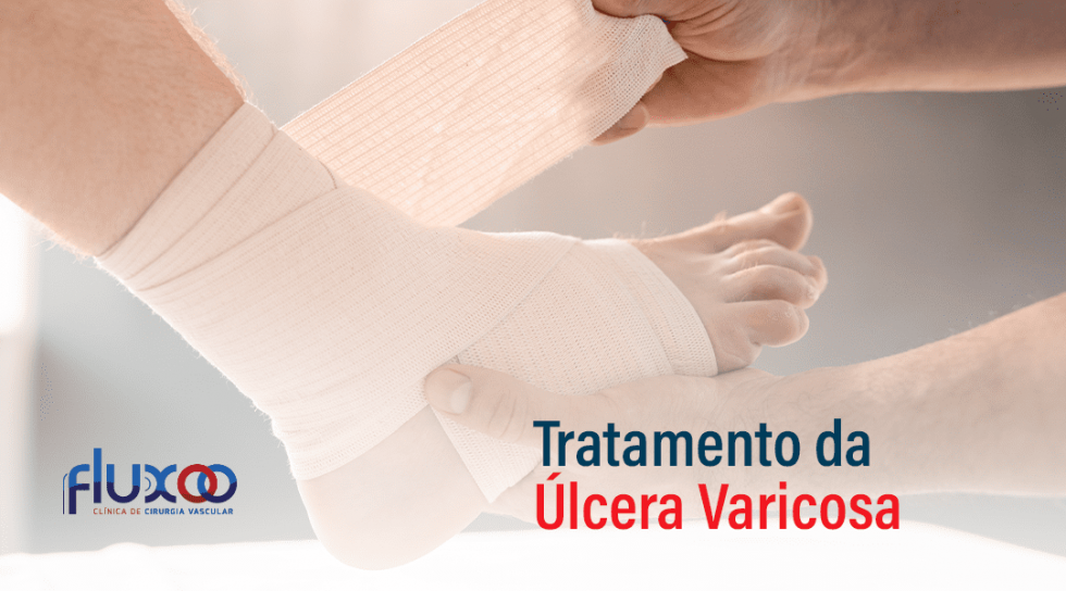 Tratamento da úlcera varicosa - Fluxo Cirurgia Vascular
