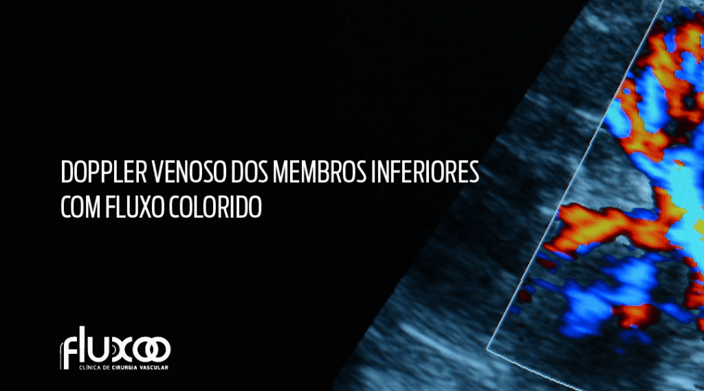 Doppler Venoso dos Membros Inferiores com Fluxo Colorido