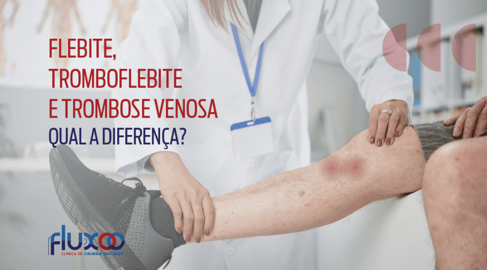 Qual a diferença entre flebite, tromboflebite e trombose venosa?