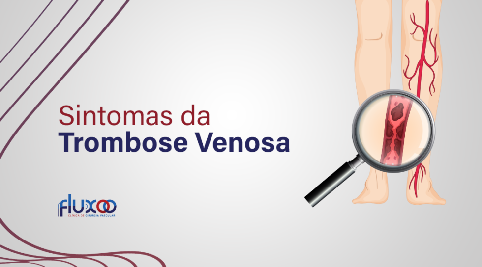 Sintomas da Trombose Venosa e do trombembolismo venoso