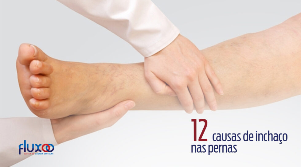 12 causas de inchaço nas pernas