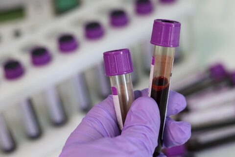 Warfarina (ou varfarina). Saiba sobre esse anticoagulante oral